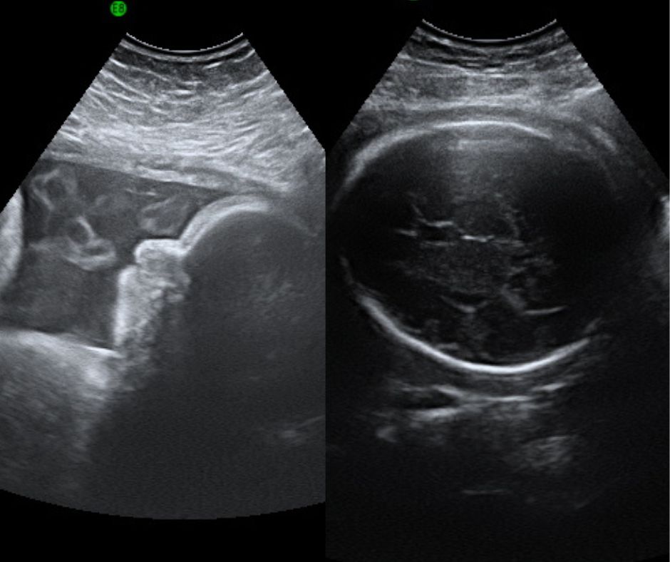 Ultrasound Best - Our Services - Presentation Scans